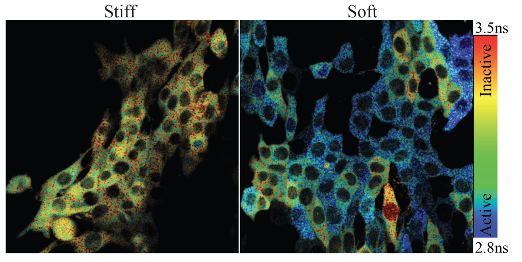 Imaging the mechanics of triple-negative breast cancer to advance ...